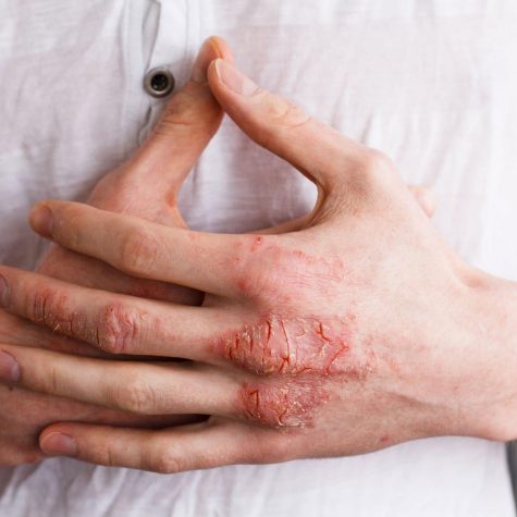 Common Skin Conditions | Skin Condition Diagnosis